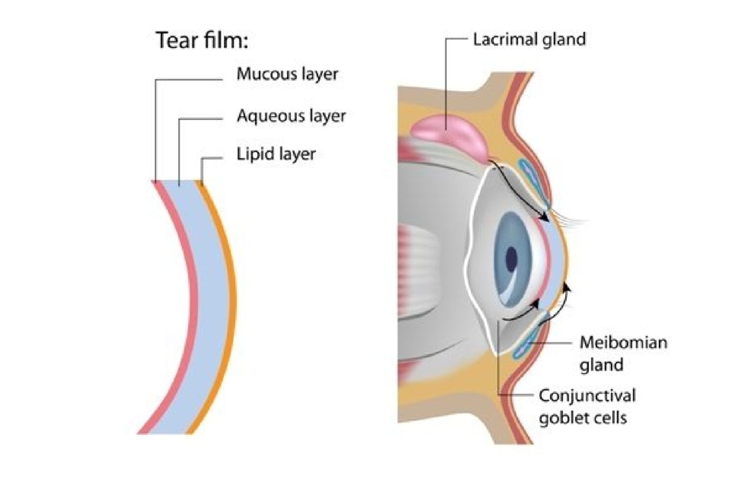 What Is a Dry Eye Flare-Up? | Lincoln, NE